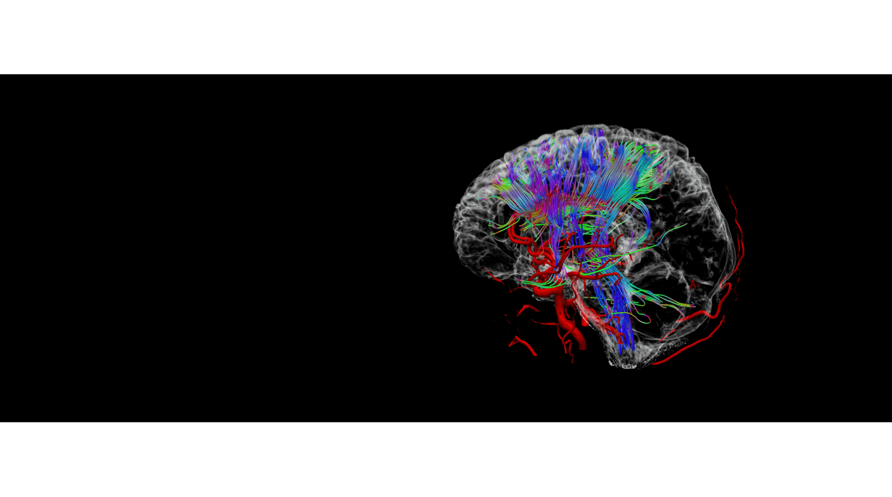 United Neuro (uWS, uReal, uSmart) | United-Imaging Healthcare