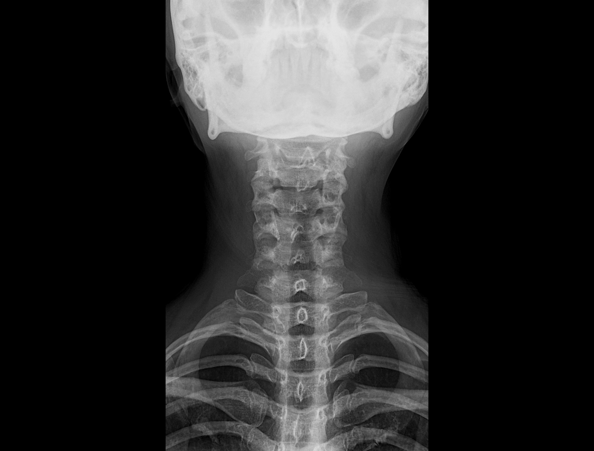 uDR 566i, digital medical X-ray imaging system