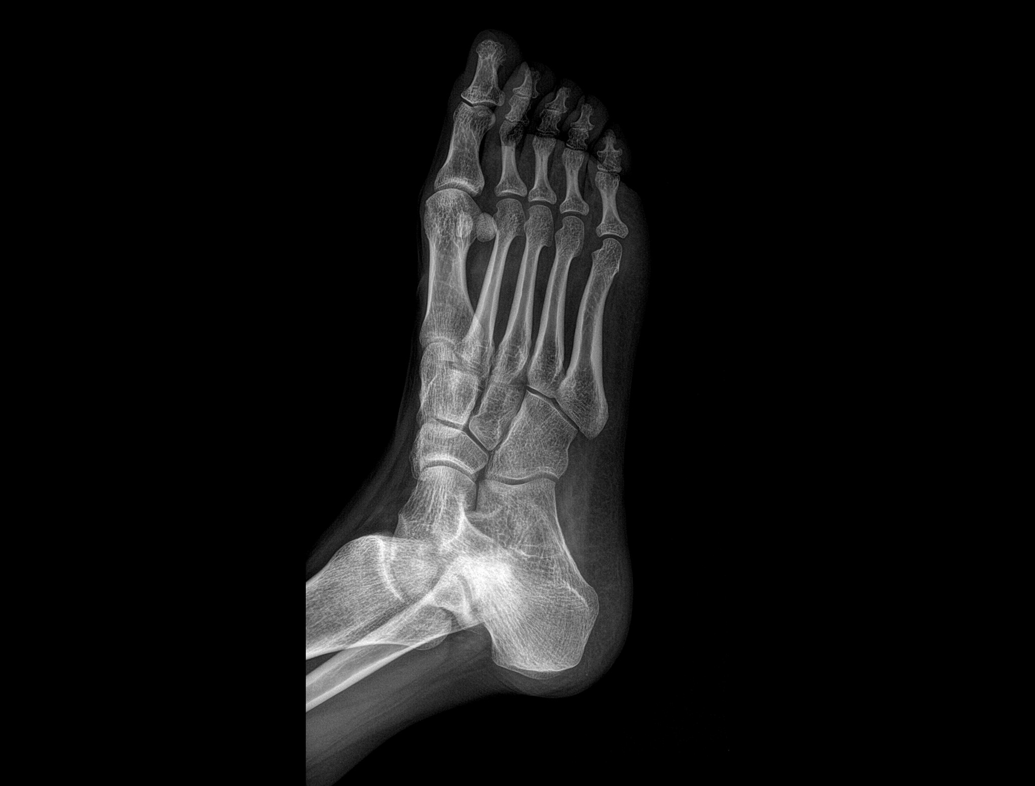 uDR 566i, digital medical X-ray imaging system