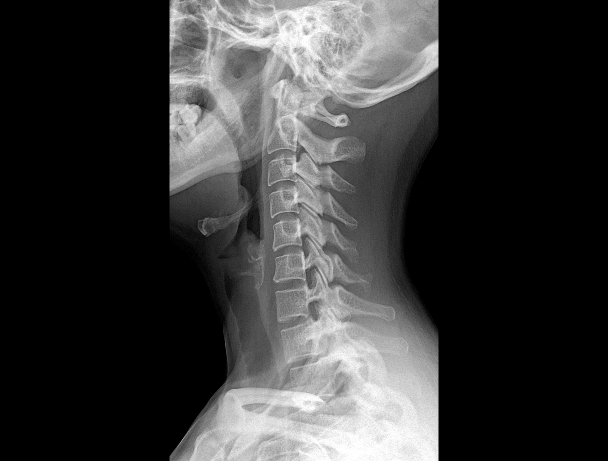 uDR 566i, digital medical X-ray imaging system