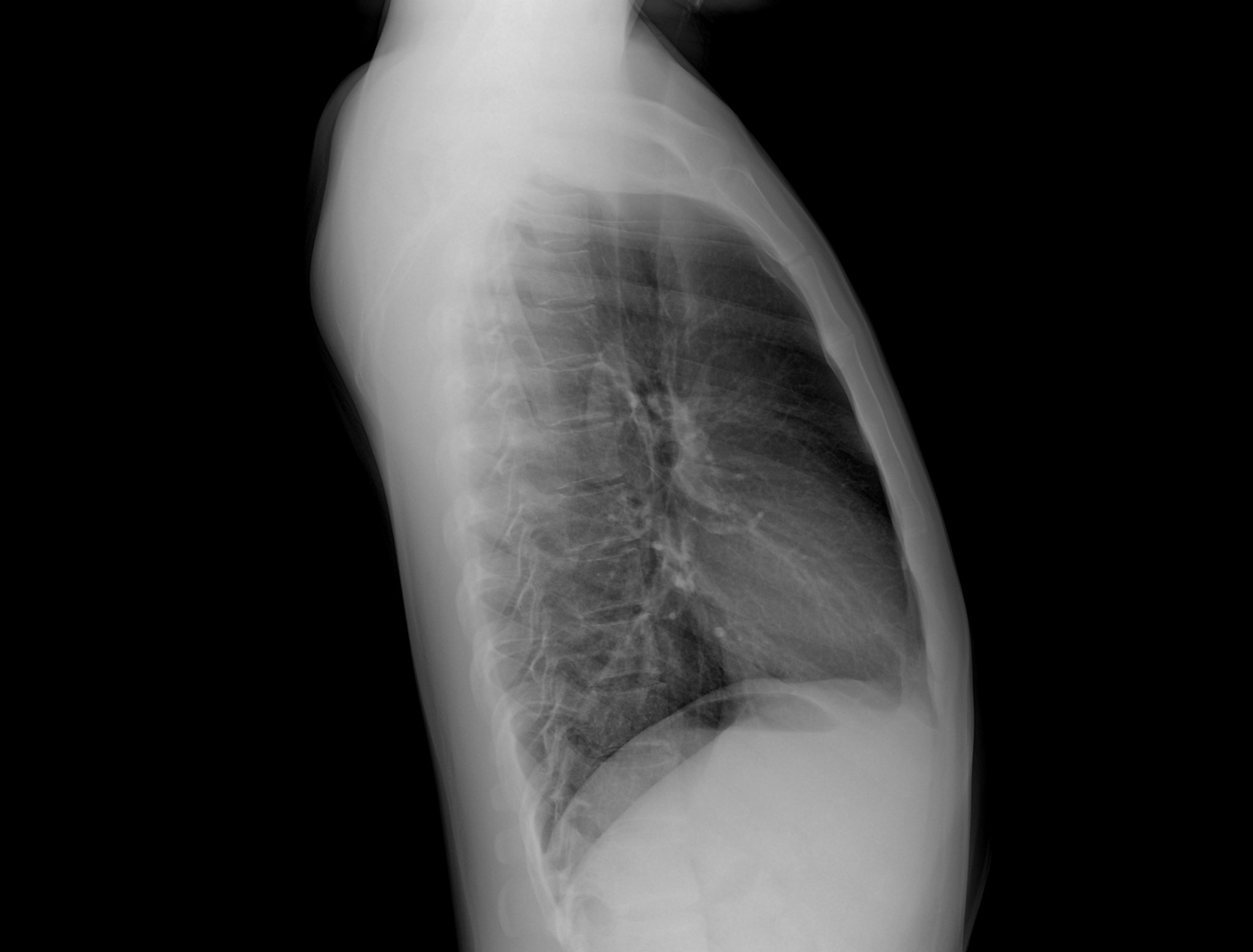 uDR 566i, digital medical X-ray imaging system
