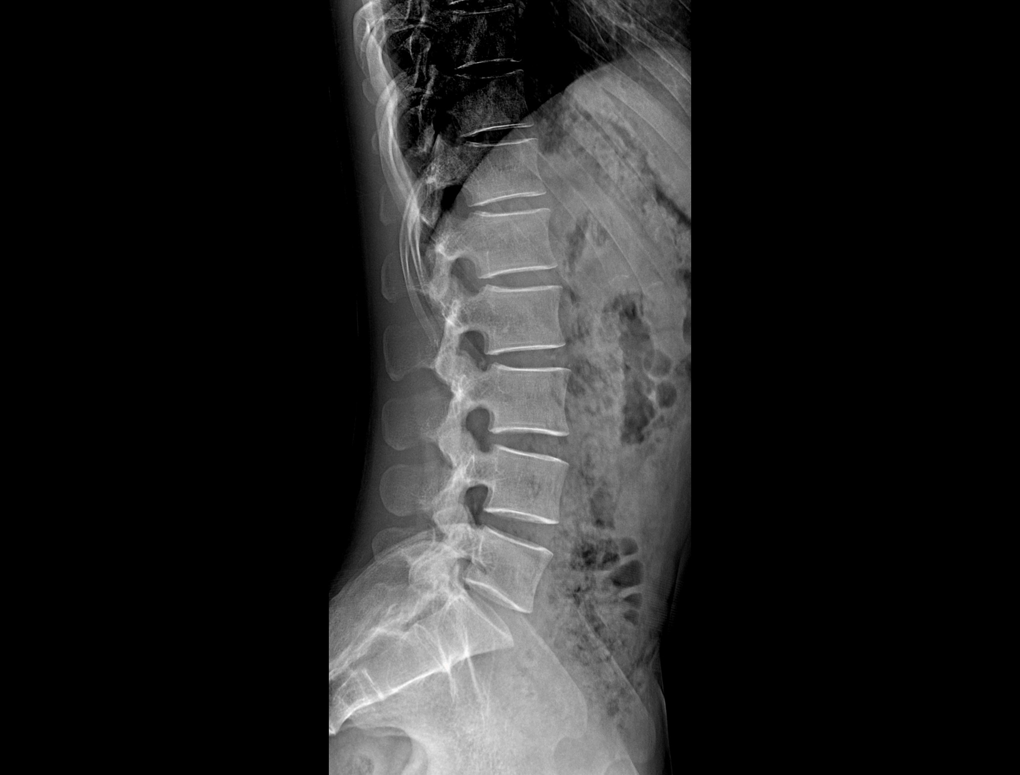 uDR 566i, digital medical X-ray imaging system