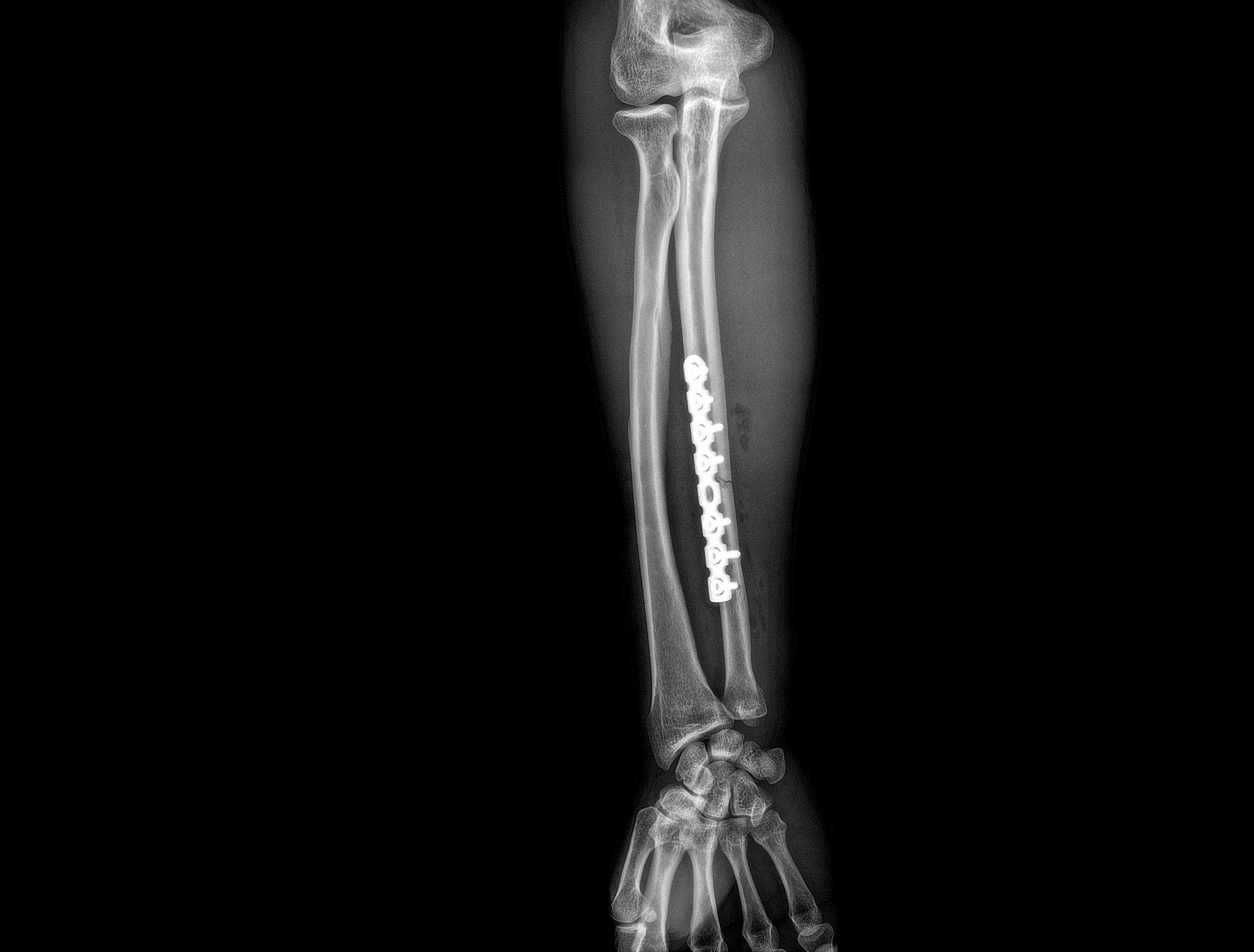 uDR 566i, digital medical X-ray imaging system