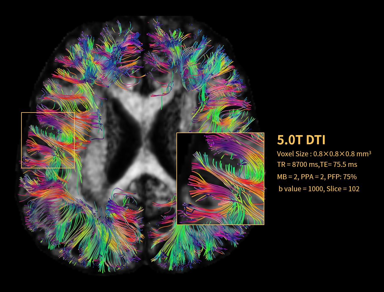 Jupiter 5.0T: The World's 1st Whole-Body UHF MRI
