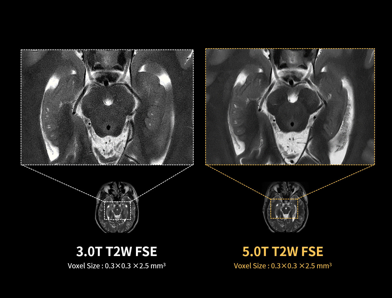 Jupiter 5.0T: The World's 1st Whole-Body UHF MRI