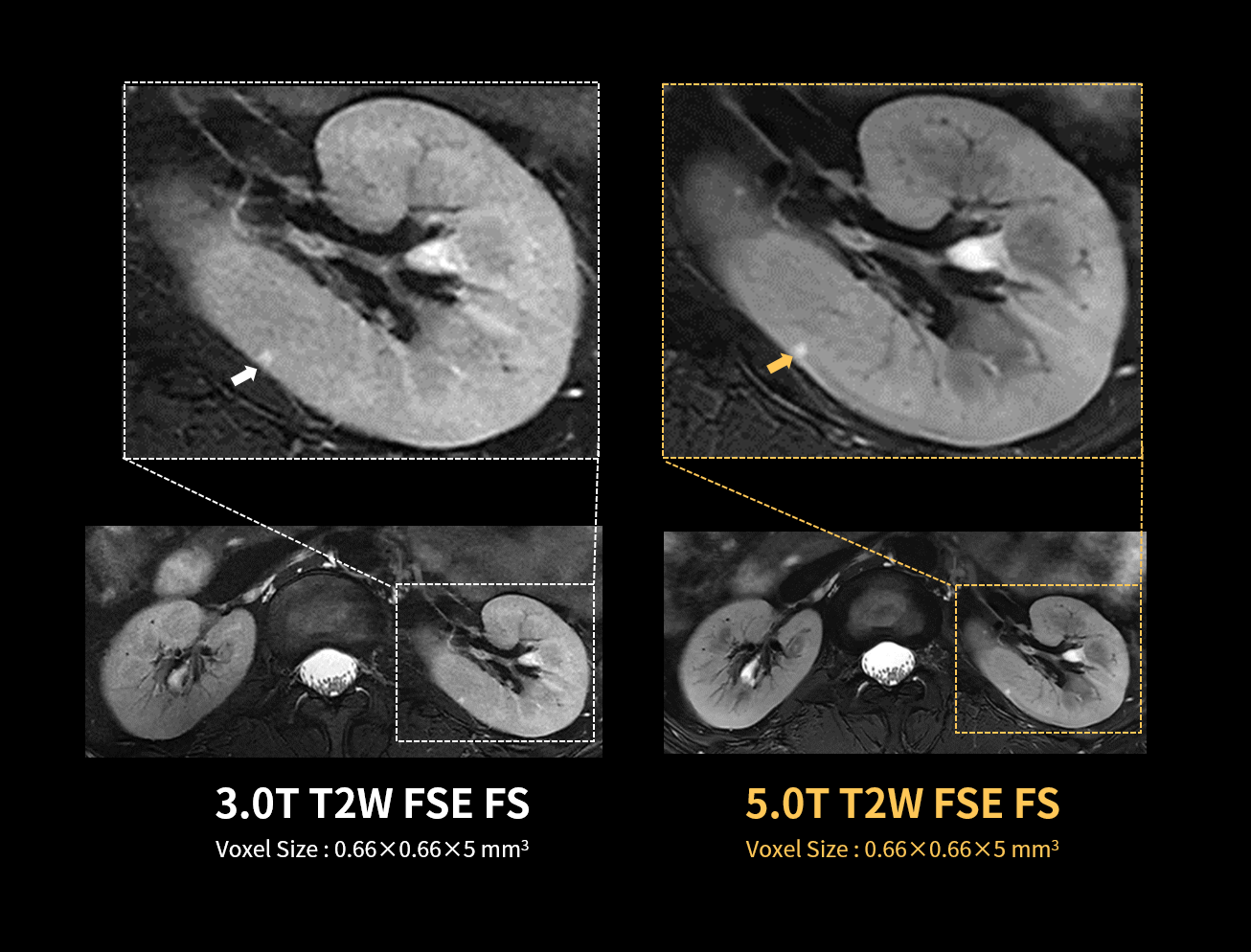 Jupiter 5.0T: The World's 1st Whole-Body UHF MRI