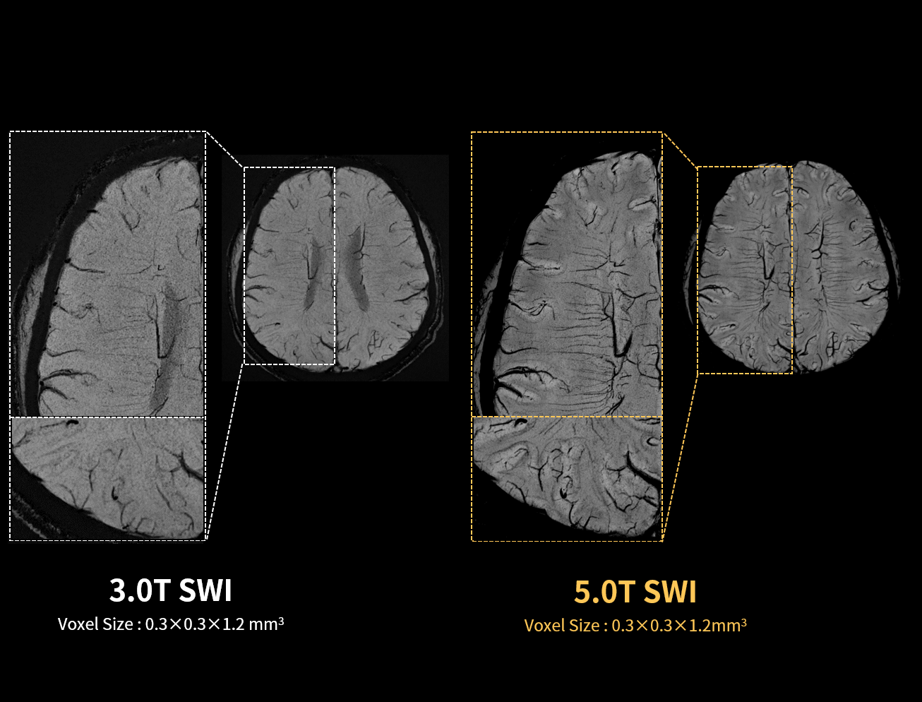 Jupiter 5.0T: The World's 1st Whole-Body UHF MRI