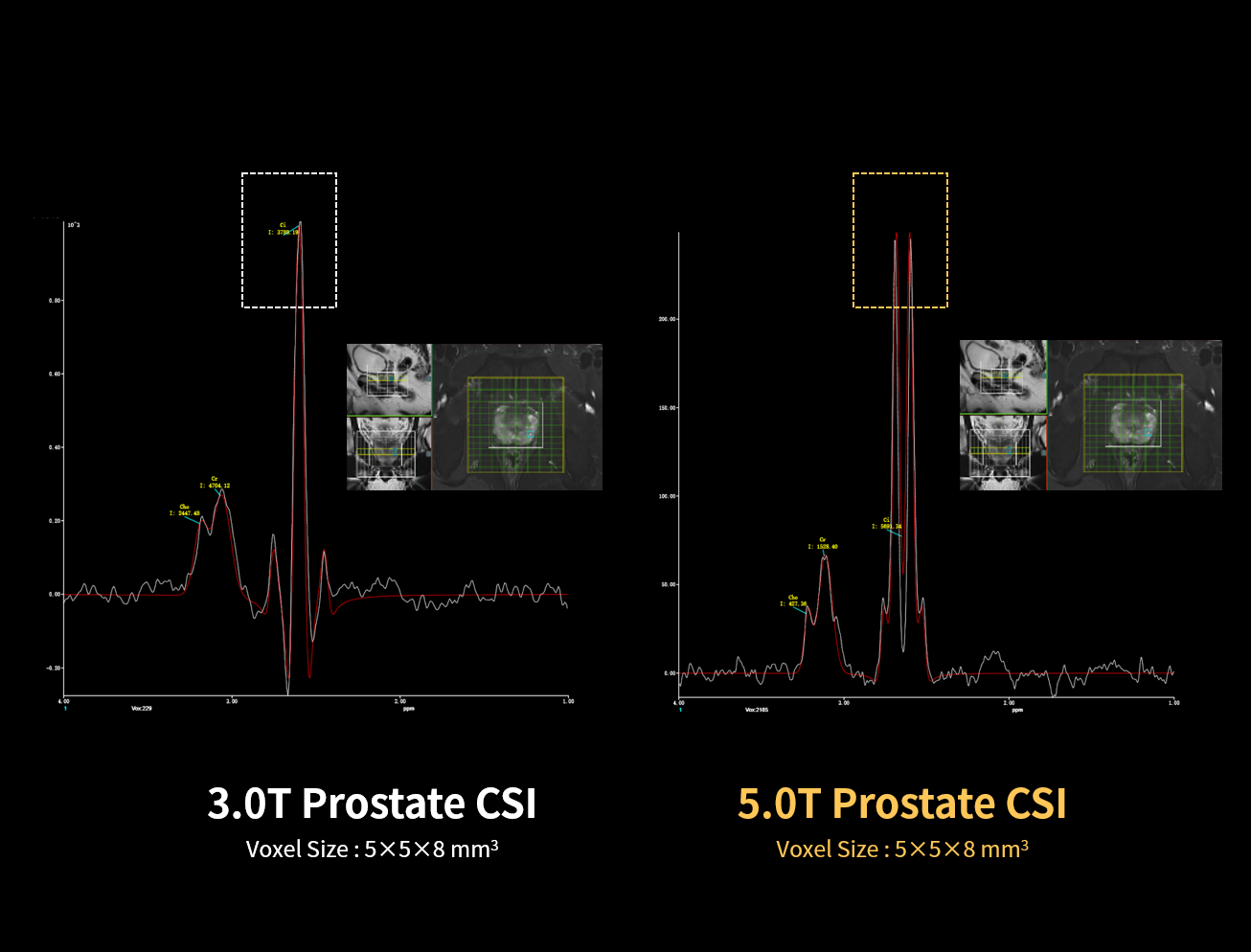 Jupiter 5.0T: The World's 1st Whole-Body UHF MRI