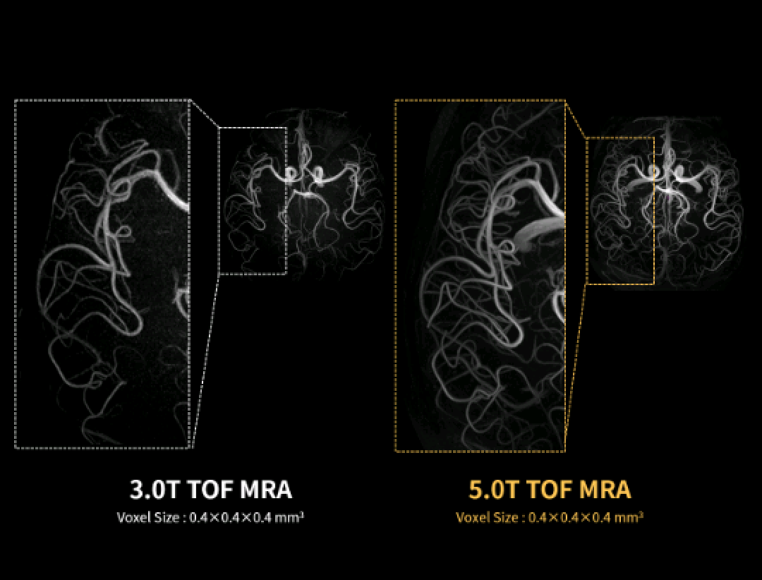 Jupiter 5.0T: The World's 1st Whole-Body UHF MRI