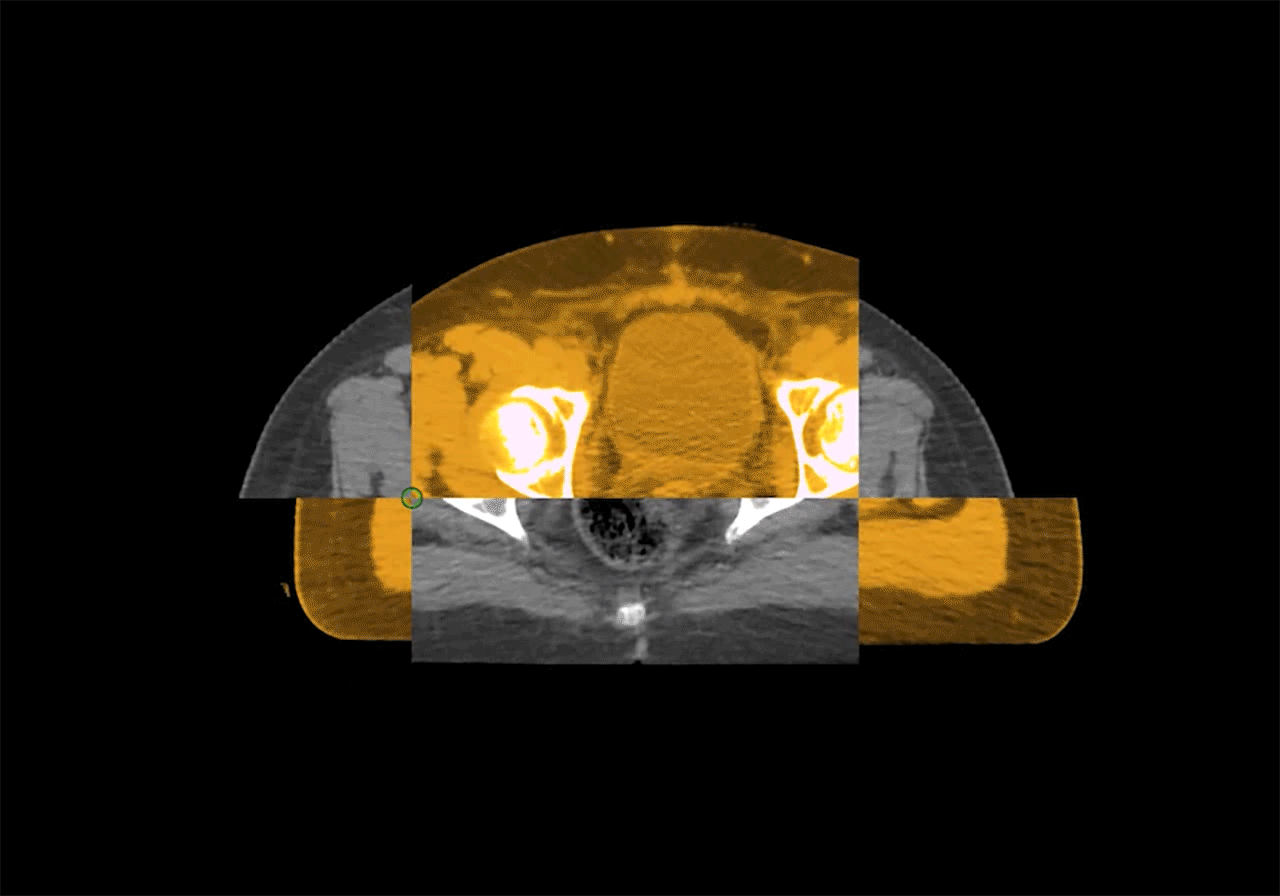 uRT-linac 506c (Integrated CT-linac) | United-Imaging