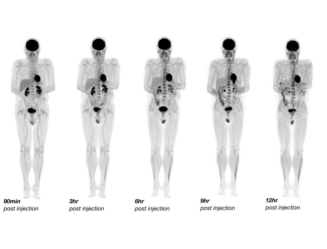 uEXPLORER®: Total-body PET/CT | United-Imaging Healthcare