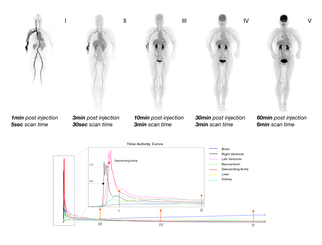 uEXPLORER®: Total-body PET/CT | United-Imaging Healthcare