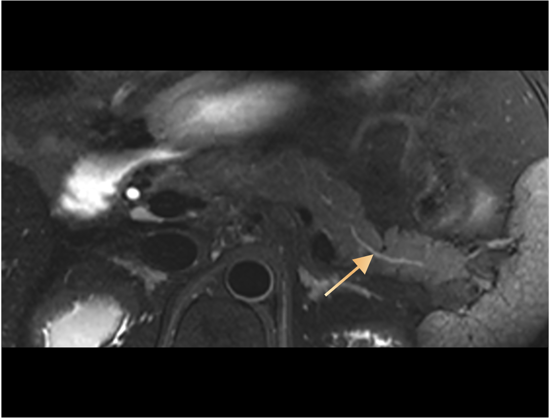 Jupiter 5.0T: The World's 1st Whole-Body UHF MRI