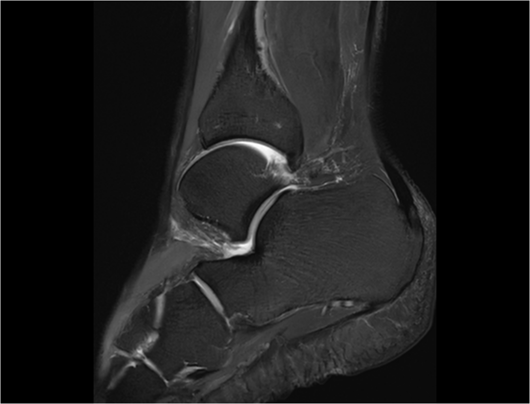 Jupiter 5.0T: The World's 1st Whole-Body UHF MRI