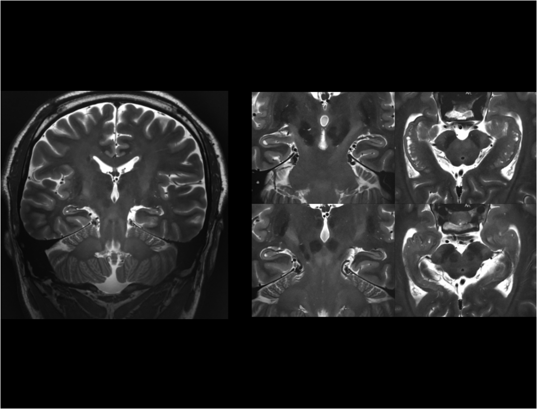 Jupiter 5.0T: The World's 1st Whole-Body UHF MRI