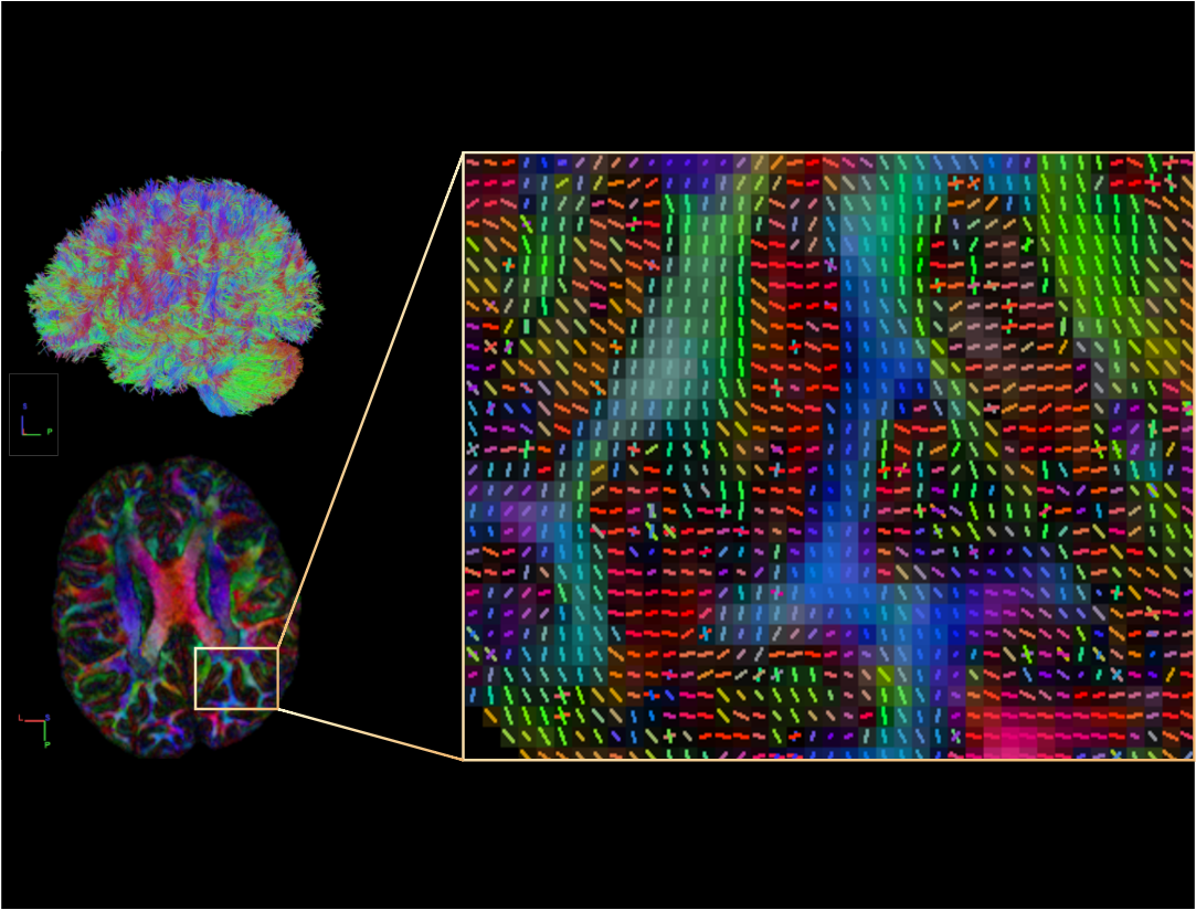 Jupiter 5.0T: The World's 1st Whole-Body UHF MRI