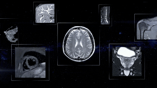 uMR® 680: uAIFI DeepRecon+EasySense | United-Imaging