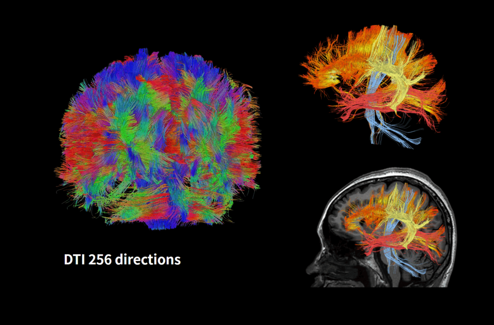 uMR® 680: uAIFI DeepRecon+EasySense | United-Imaging