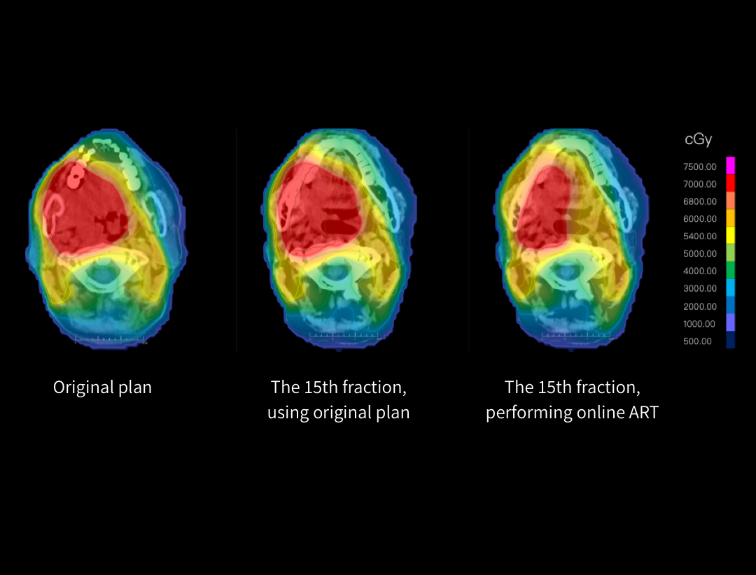 uRT-linac 506c (Integrated CT-linac) | United-Imaging