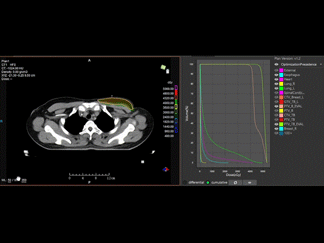uRT-linac 506c (Integrated CT-linac) | United-Imaging
