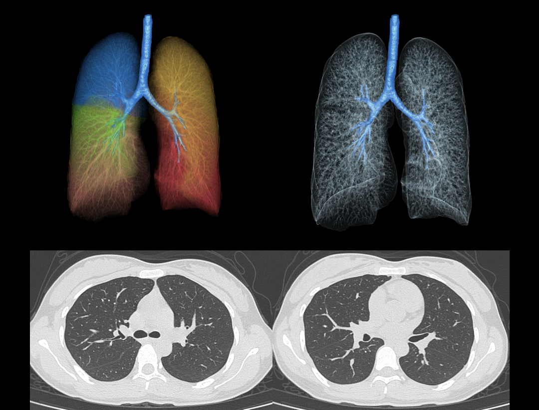 uCT 520 (High Efficiency+Low Cost) | United-Imaging Healthcare