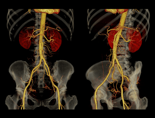 uCT 520 (High Efficiency+Low Cost) | United-Imaging Healthcare