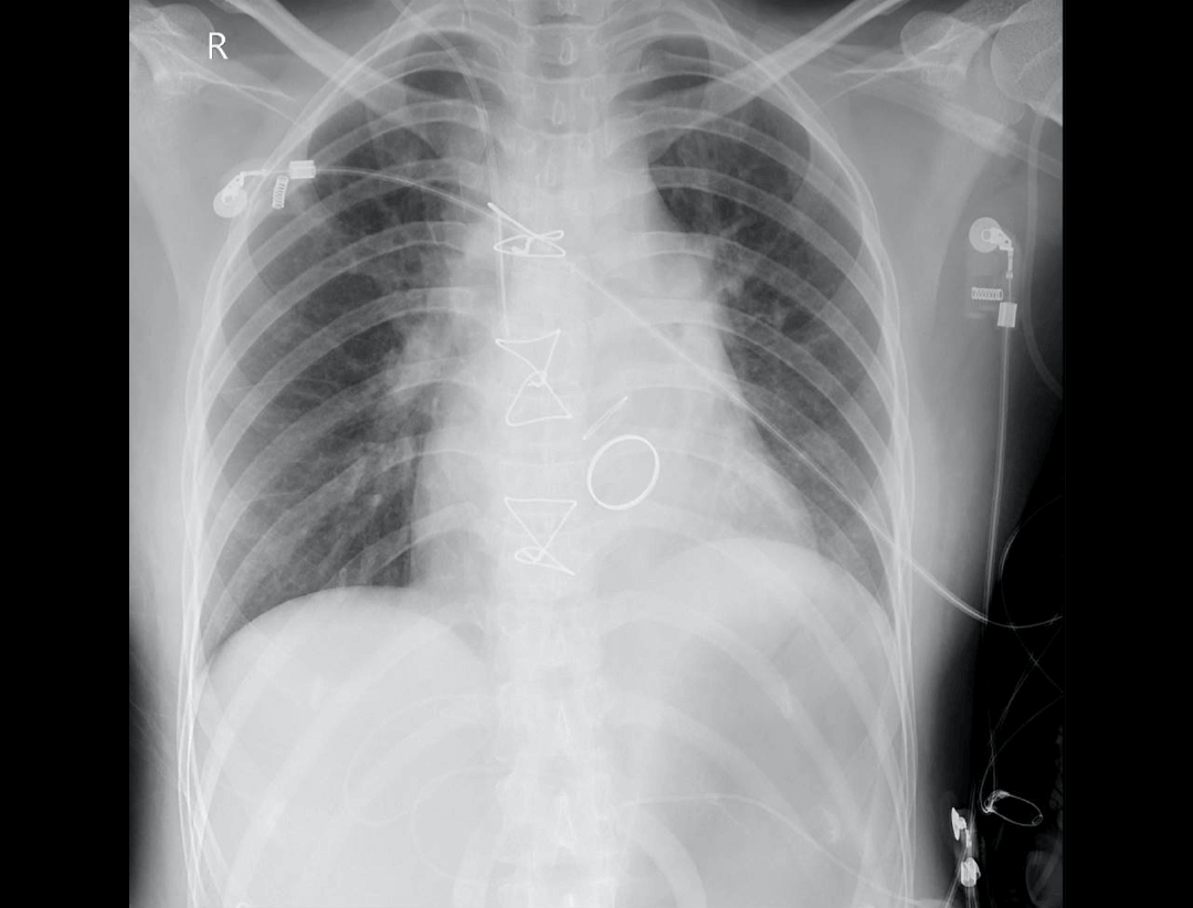 uDR 380i Pro (Remote-Vision Mobile DR) | United-Imaging