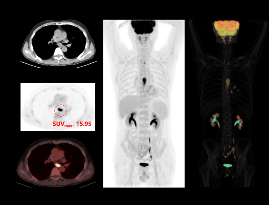 uMI 550: Digital PET/CT | United-Imaging Healthcare