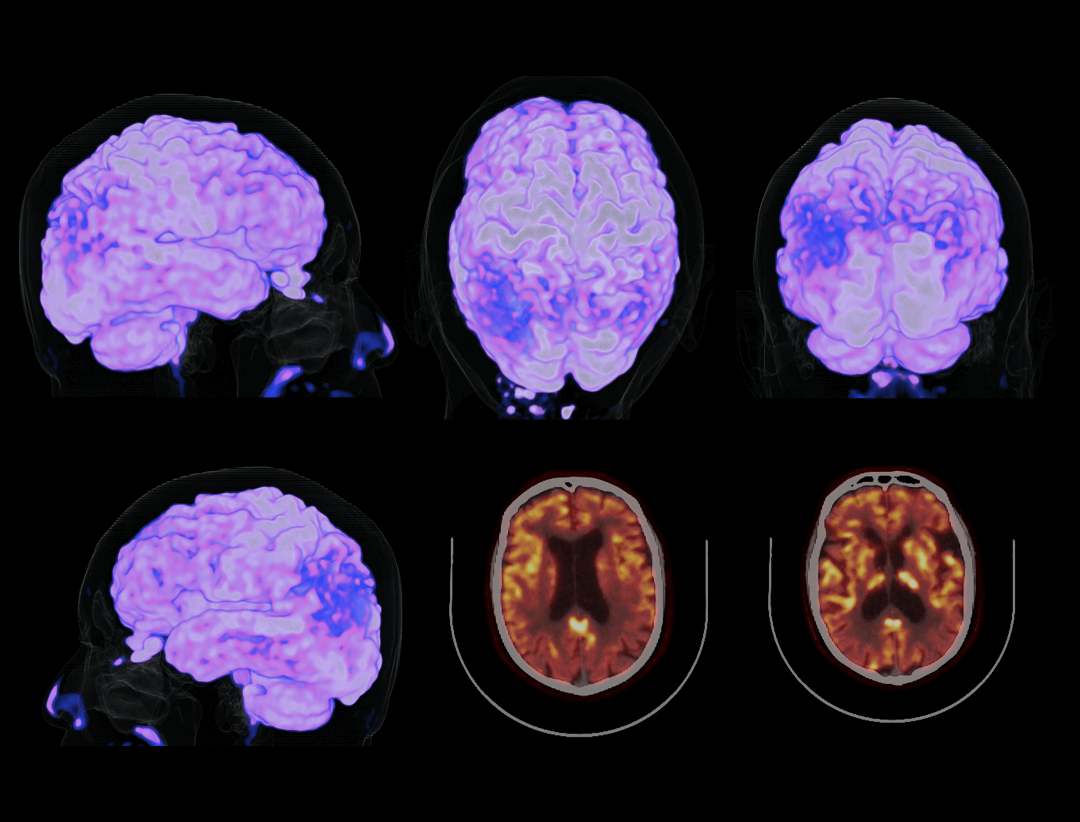 uMI 780: HD Digital PET/CT | United-Imaging Healthcare