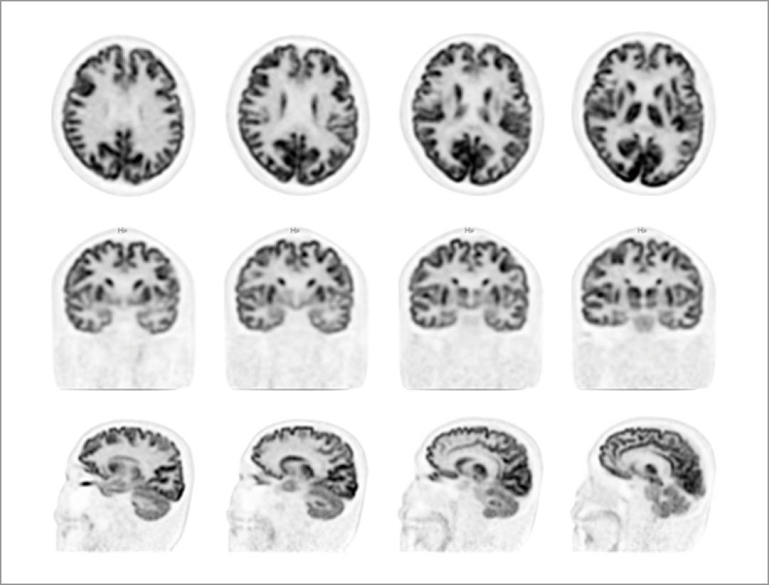uMI 550: Digital PET/CT | United-Imaging Healthcare