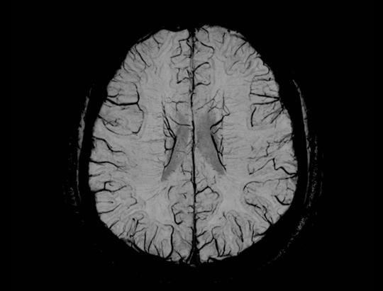 uMR Omega: Ultra-wide Bore 3.0T MR | United-Imaging