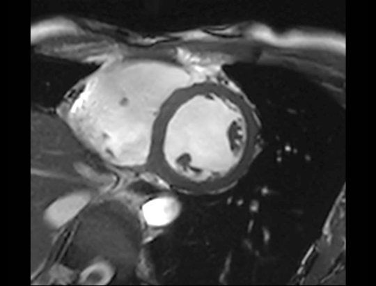 uMR Omega: Ultra-wide Bore 3.0T MR | United-Imaging