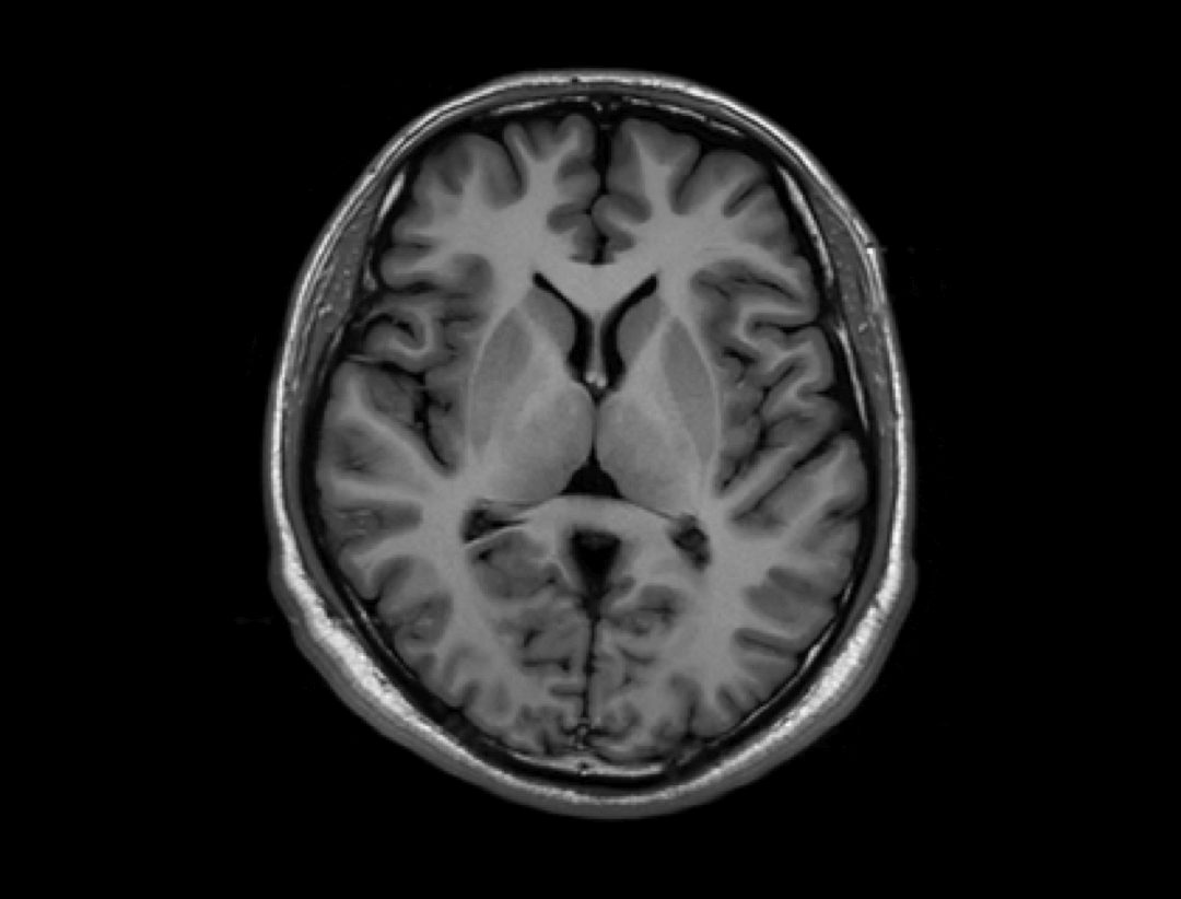 uMR® 580: Intelligent and Economic 1.5T MR | United-Imaging