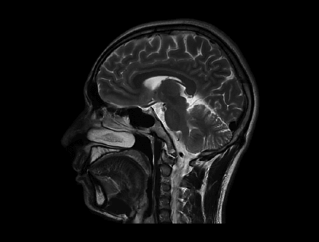 uMR® 580: Intelligent and Economic 1.5T MR | United-Imaging