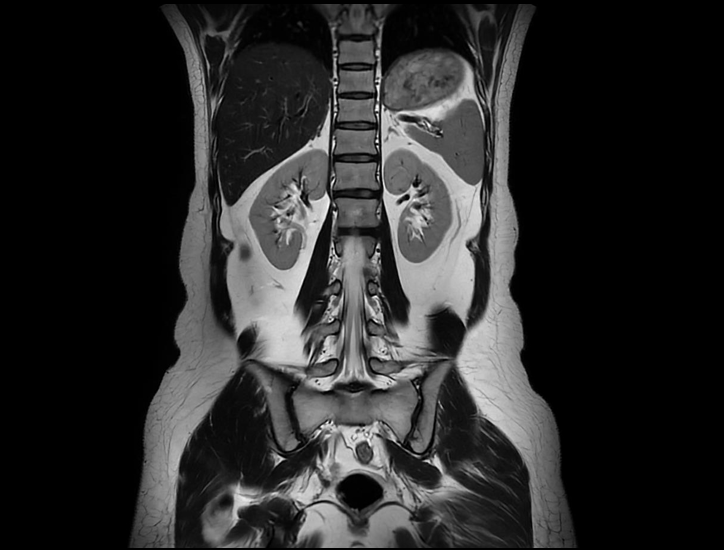 uMR Omega: Ultra-wide Bore 3.0T MR | United-Imaging
