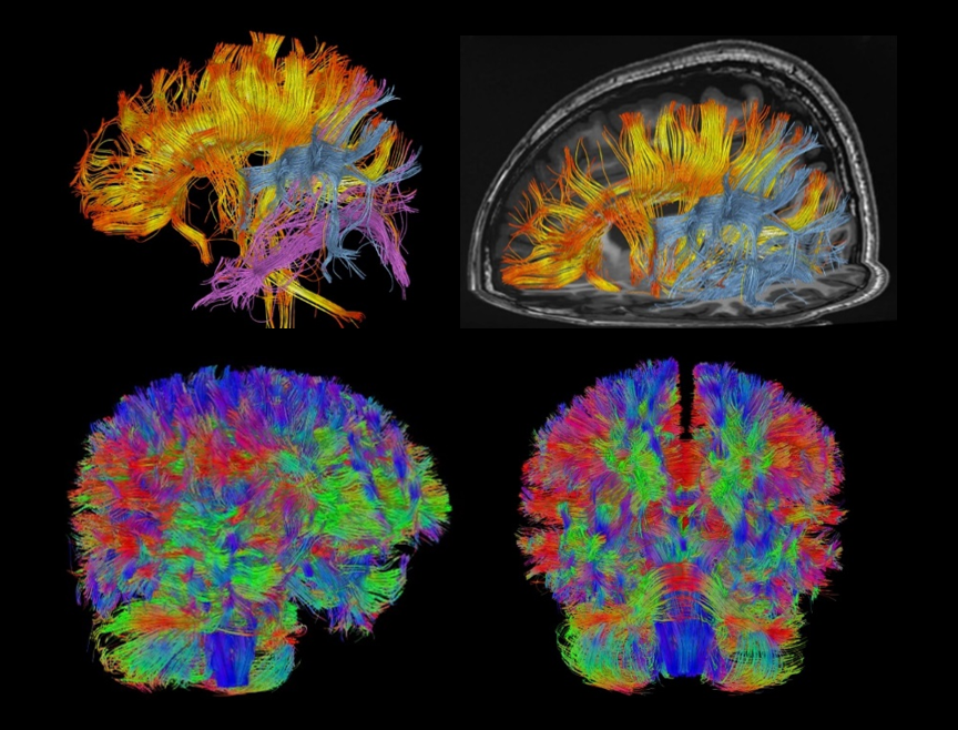 uMR Omega: Ultra-wide Bore 3.0T MR | United-Imaging