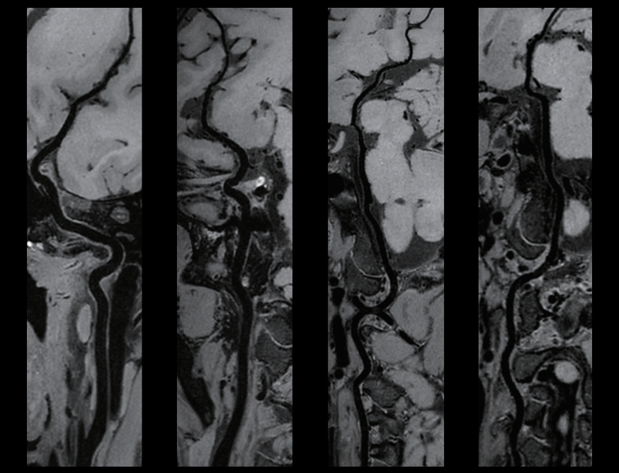 uMR® 790: 3.0T MR | United-Imaging Healthcare