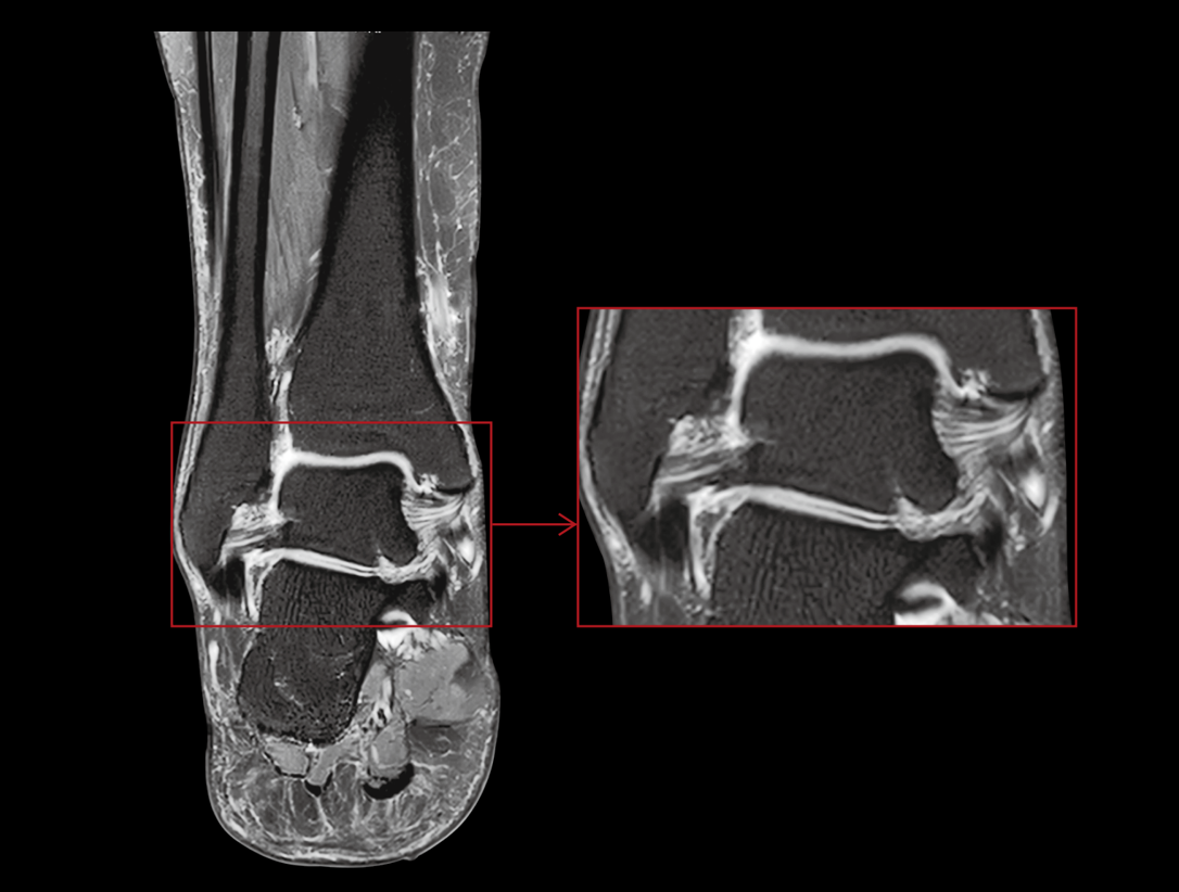 uMR® 780: ACS 3.0T MR | United-Imaging Healthcare