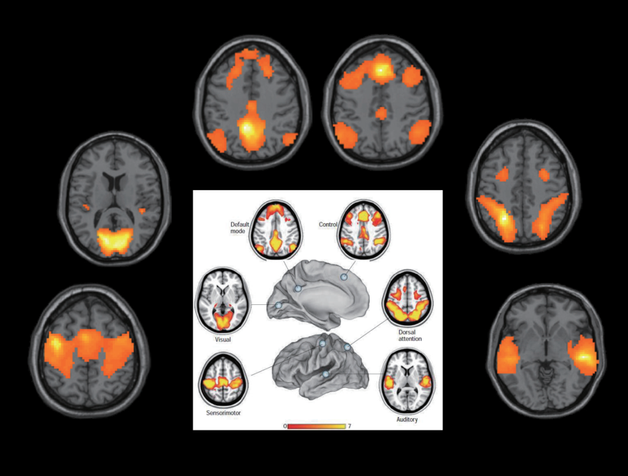 uMR® 790: 3.0T MR | United-Imaging Healthcare